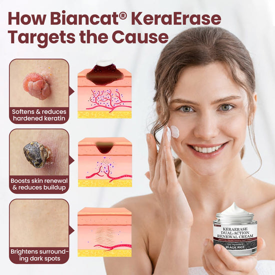 Biancat®KeraErase Dual-Action Renewal Cream – negusyshop